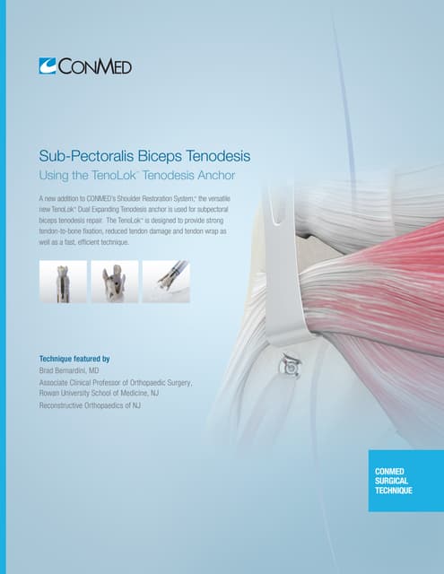 Dynamic Hip Screw Plating | PPT