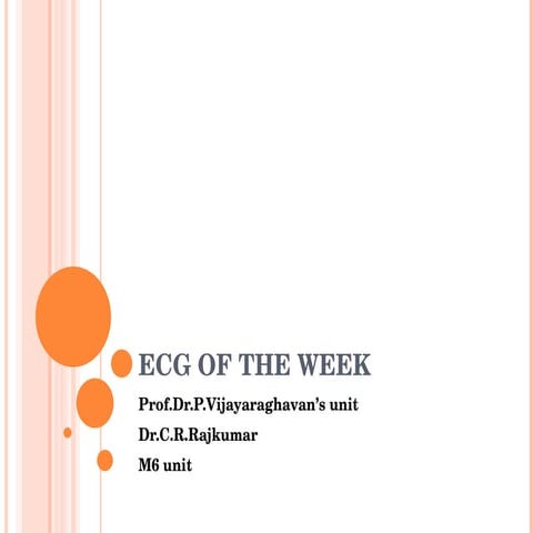 ECG: New onset AF with slow ventricular response | PPT