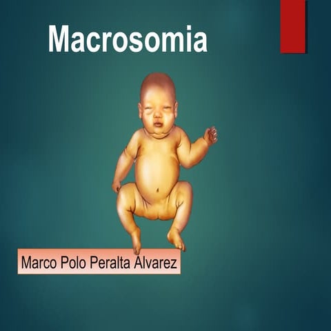 Macrosomia | PPT
