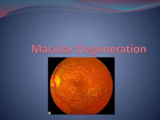 Age-Related Macular Degeneration | PPTX | Eye and Vision Conditions ...