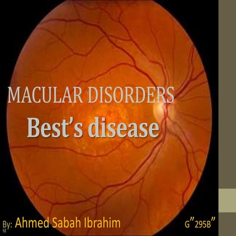 Macular disorders best disease | PPTX