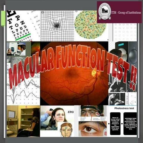 Macular function test | ODP