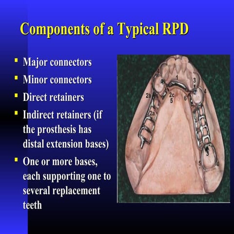 Major connectors lec3 & 4 | PPT | Dental Health | Diseases and Conditions
