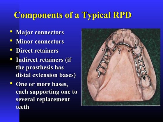 Maxillary major connectors | PPTX