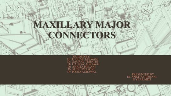 Maxillary major connectors | PPTX