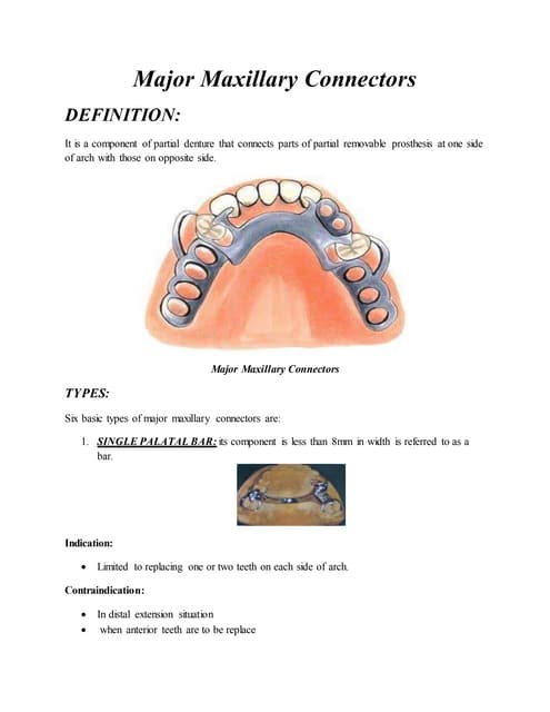 Maxillary major connectors by mohammed hekma | PPTX