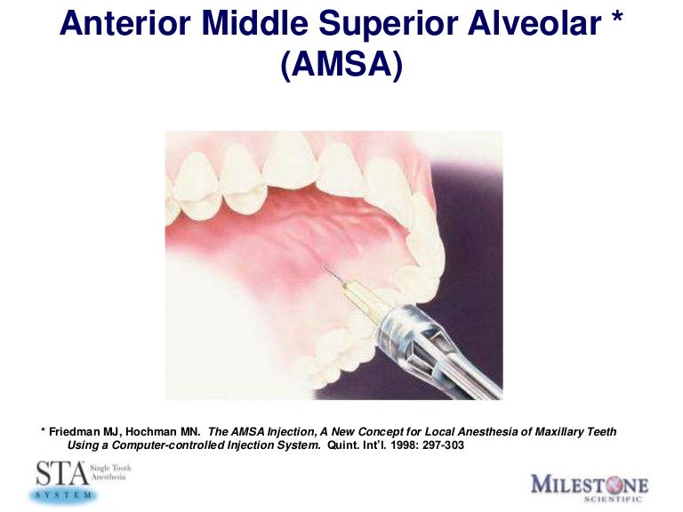 Malamed Amsa.Sta Ii 11.28.09