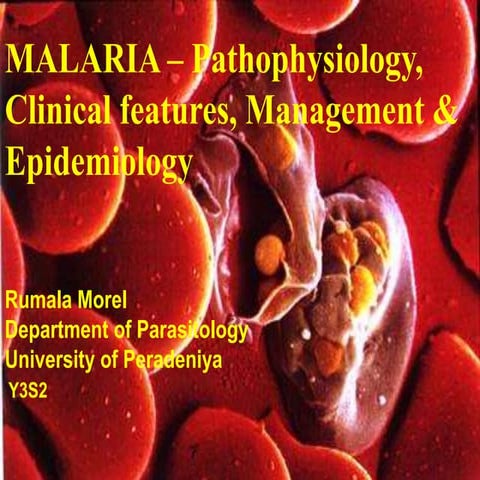 Malaria clinical | PPTX