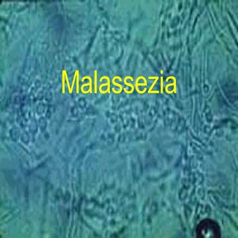 Malassezia infection | PPTX