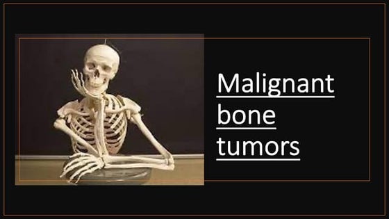 A rare case of ewing's sarcoma of VC 20-6-23.pptx