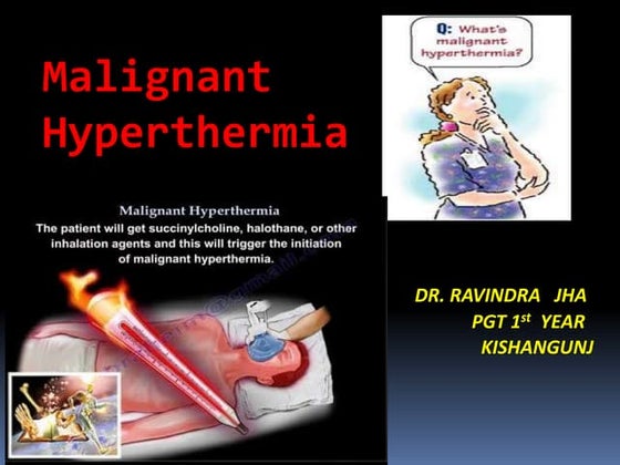 Malignant Hyperthermia Malignant Hyperthermia | PPT