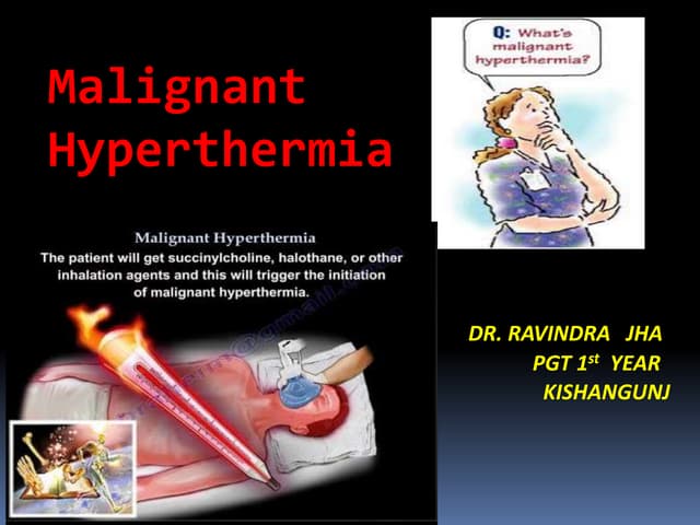 MALIGNANT HYPERTHERMIA and its management.pptx