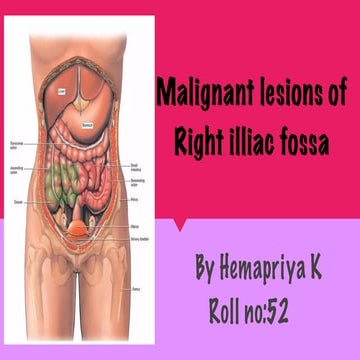 Malignant lesions of Right iliac fossa.pdf