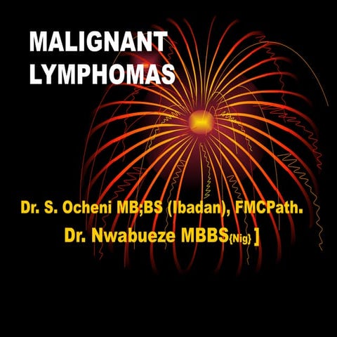 MALIGNANT LYMPHOMAS by Ocheni and Nwabueze | PPT