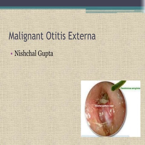 Malignant otitis media