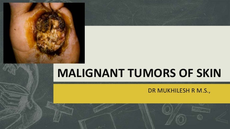 Malignant tumors of skin