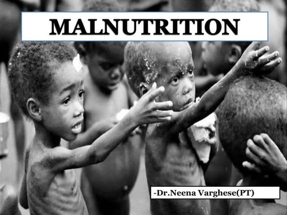 Malnutrition consequences, causes, prevention and control | PPT