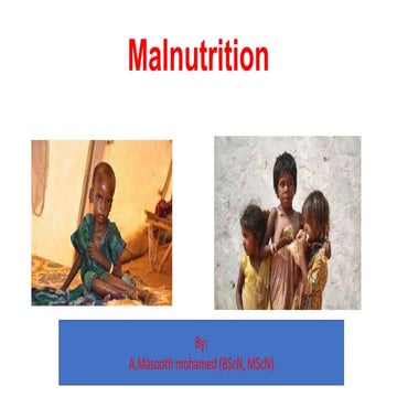 Malnutrition.pptx