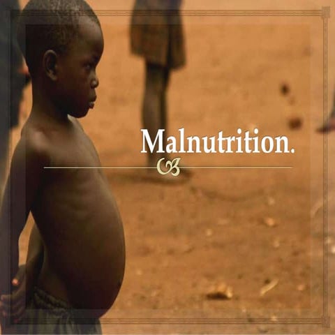 malnutrition.pptx