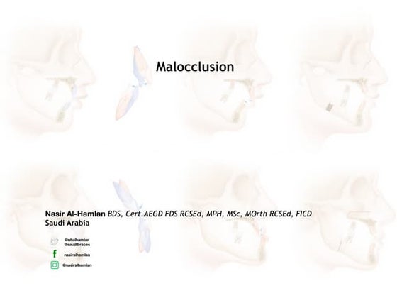 Modifications of angle`s classification | PPT