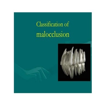 MALOCLUSION.definition, characteristics, treatment | PPT