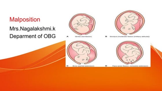 Fetal Presentation | PPTX