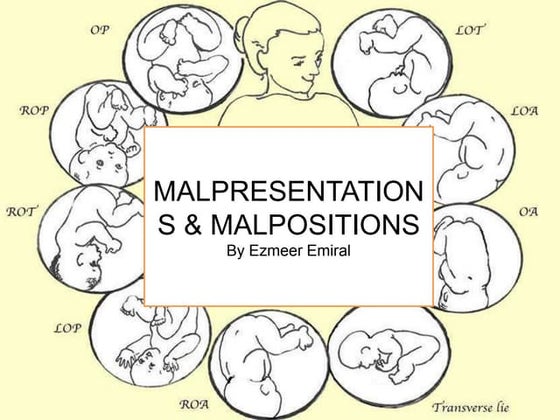 Fetal Presentation | PPTX