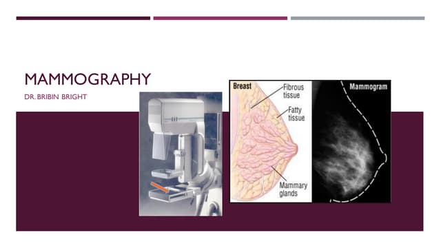 Mammography positioning technique for Lateral Views (LM/ML) | PPTX