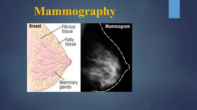 Mammography physics and technique | PPTX