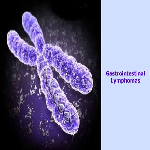 Management of Gastrointestinal Lymphomas | PPT