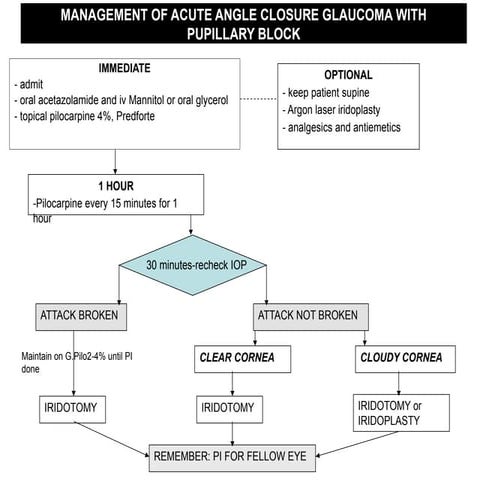 Management of Acute Angle-closure glaucoma with pupillary block.pptx