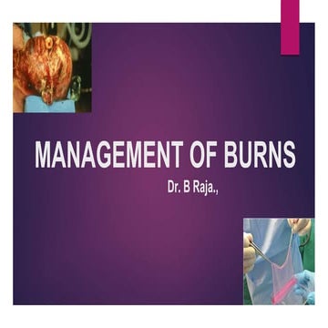 Management of burns | PPTX