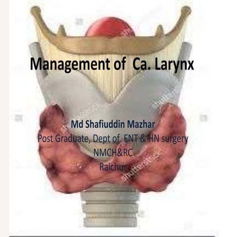 Management of ca. larynx | PPTX