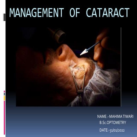 MANAGEMENT OF CATARACT.ppsx