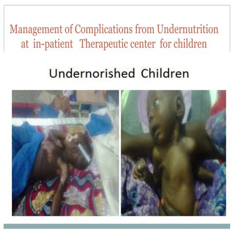 Management of Severe acute malnutrition. Management of severe acute ...