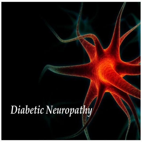 Management+of+Diabetic+Neuropathy | PPT