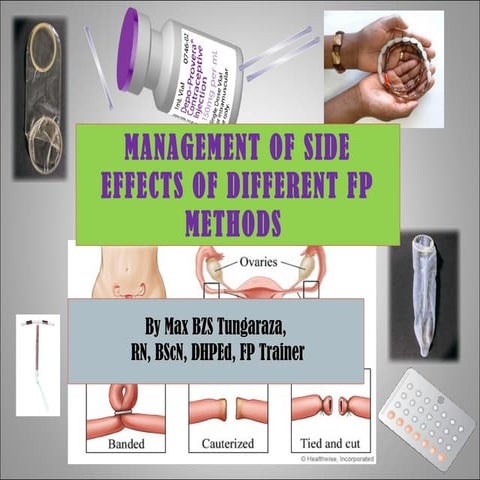 Management of fp side effects2 | PPT