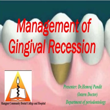 MANAGEMENT OF GINGIVAL RECESSION BY DR.HEMRAJ PANDIT.pptx