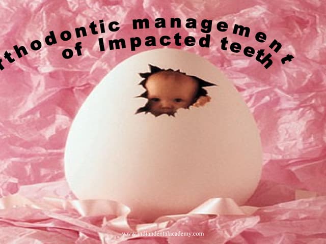 Parallel angle technique vs bisecting angle technique. | PPTX