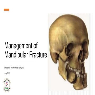 Management of Mandibular fractures.pptx