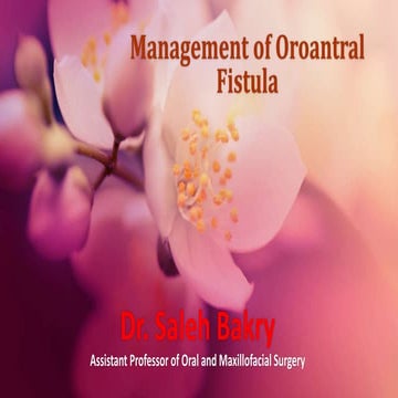 Management of oroantral fistula | PPTX