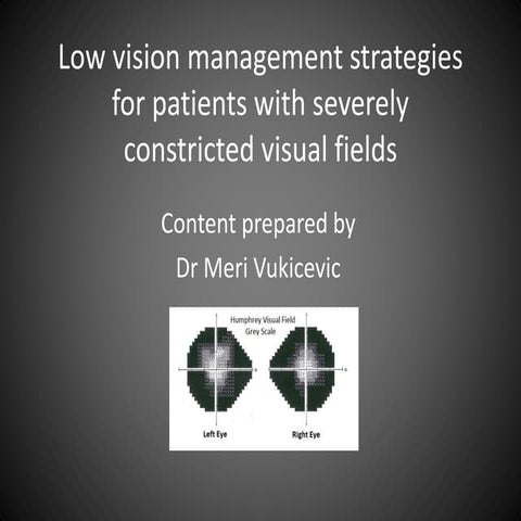 Management of peripheral vision loss | PPTX