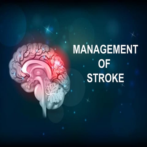 Management Of Stroke in high risk patient group | PPT
