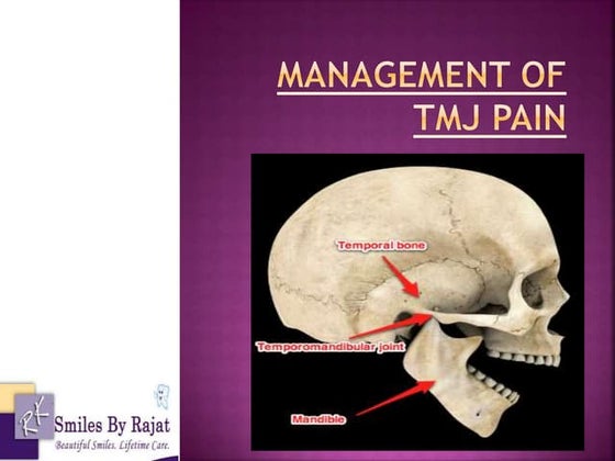 Botox for your TMJ (tempero mandibular joint) by Dr.Rajat Sachdeva ...