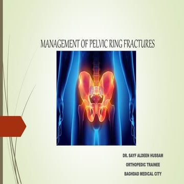 Management of pelvic ring fractures [autosaved] | PPTX