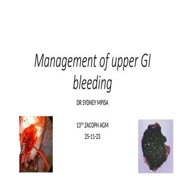 Management of upper GI bleeding-undergraduates.pptx