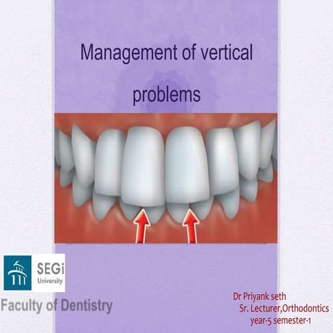 Management of vertical malocclusions.pptx