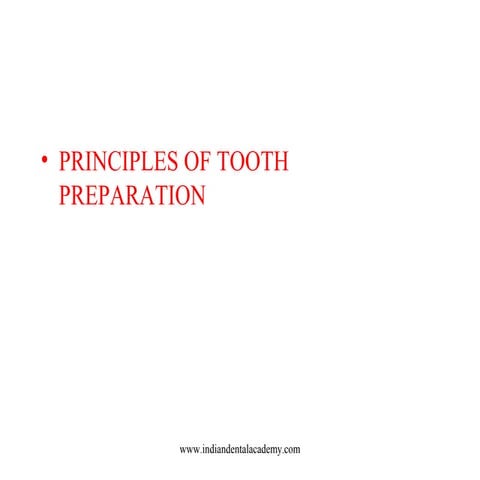 Ferrule effect | PPSX