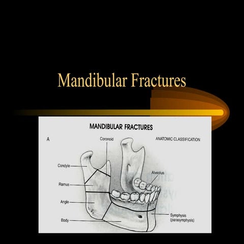 Mandible fracture signs and symptoms ppt | PPT