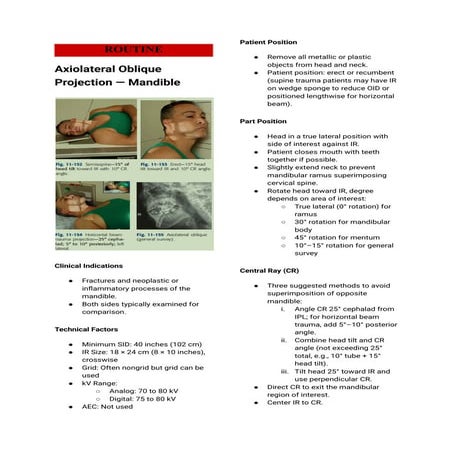 Positioning and radiographic anatomy of the skull | PPT